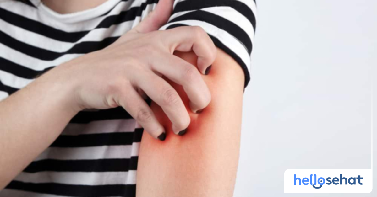 Gejala Alergi Dingin yang Paling Sering Dikeluhkan - Hello Sehat