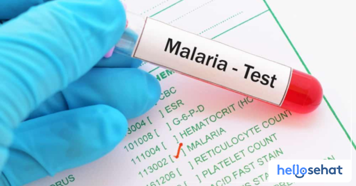 Tanda dan Gejala Malaria yang Tidak Boleh Anda Abaikan