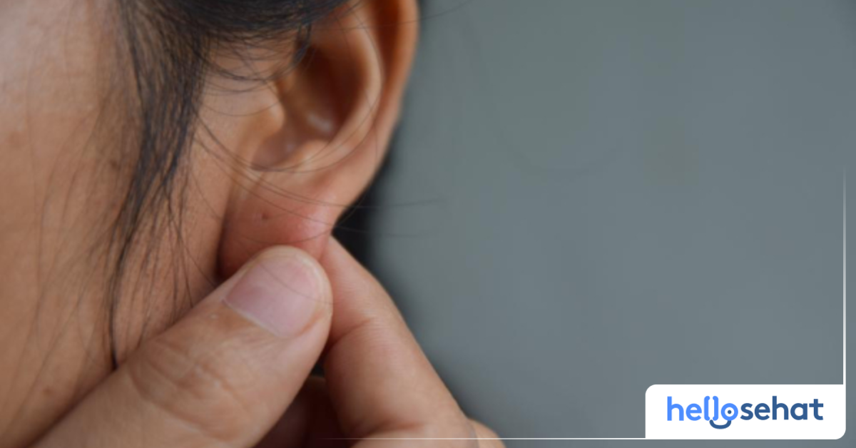 Cara Menghilangkan Keloid di Telinga yang Efektif Lewat Tindakan Medis