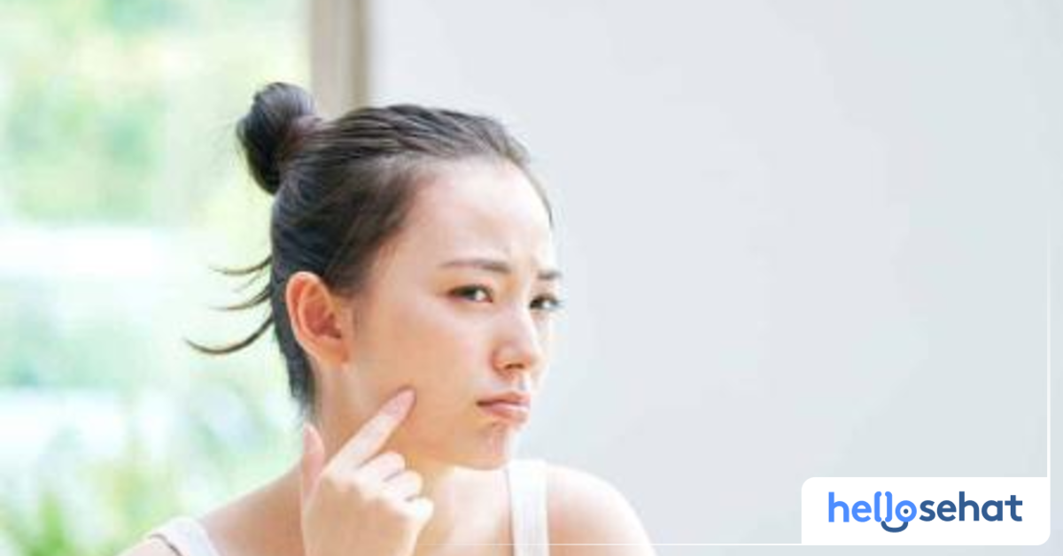 4 Ciri-Ciri Kulit Wajah Kusam dan Perawatan yang Tepat