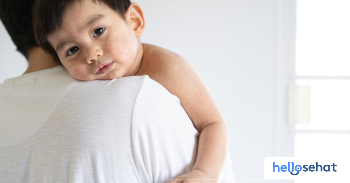 Pahami Perbedaan Demam Scarlet dan Campak - Hello Sehat