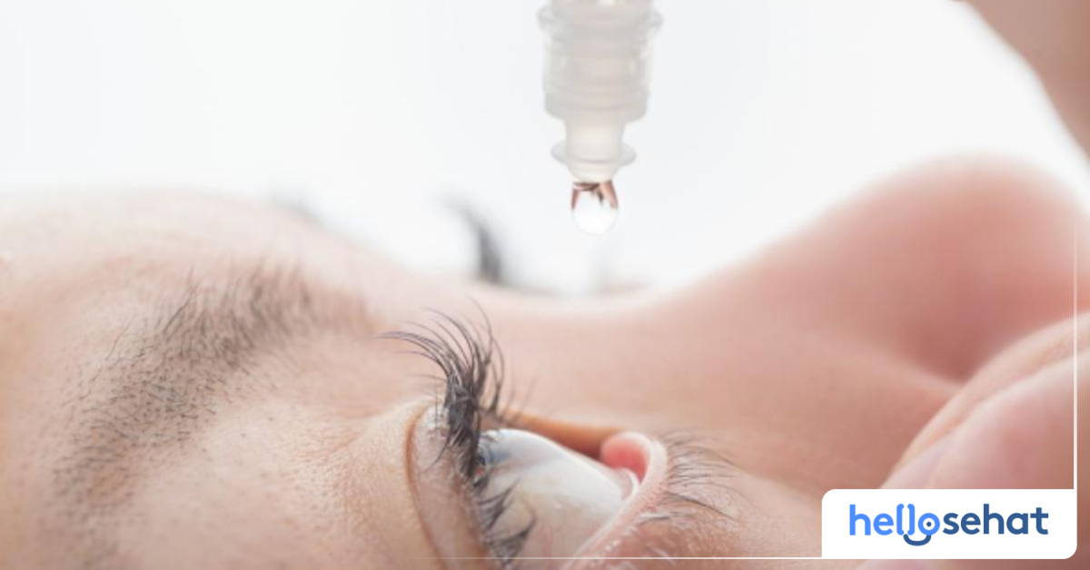 Cara Memakai Obat Tetes Mata yang Baik dan Benar