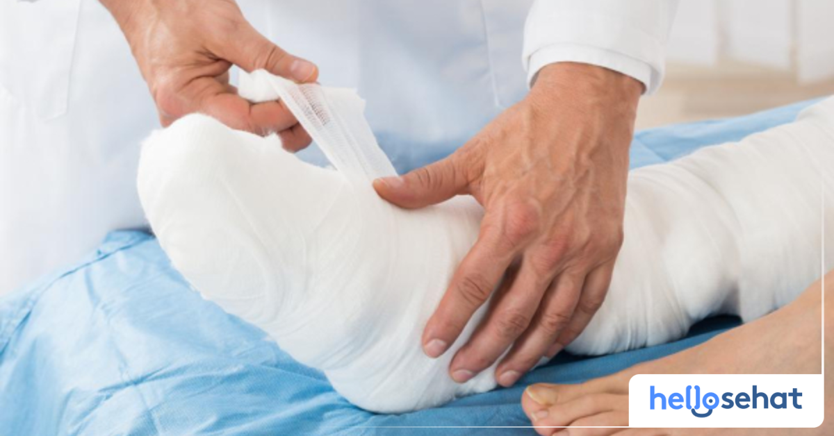 Gips Patah Tulang: Ketentuan Prosedur dan Perawatan