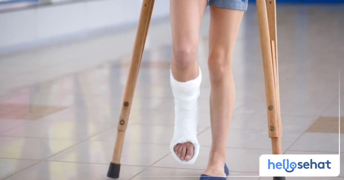 Saat Menggunakan Tongkat Kruk yang Benar Ketika Cedera Kaki