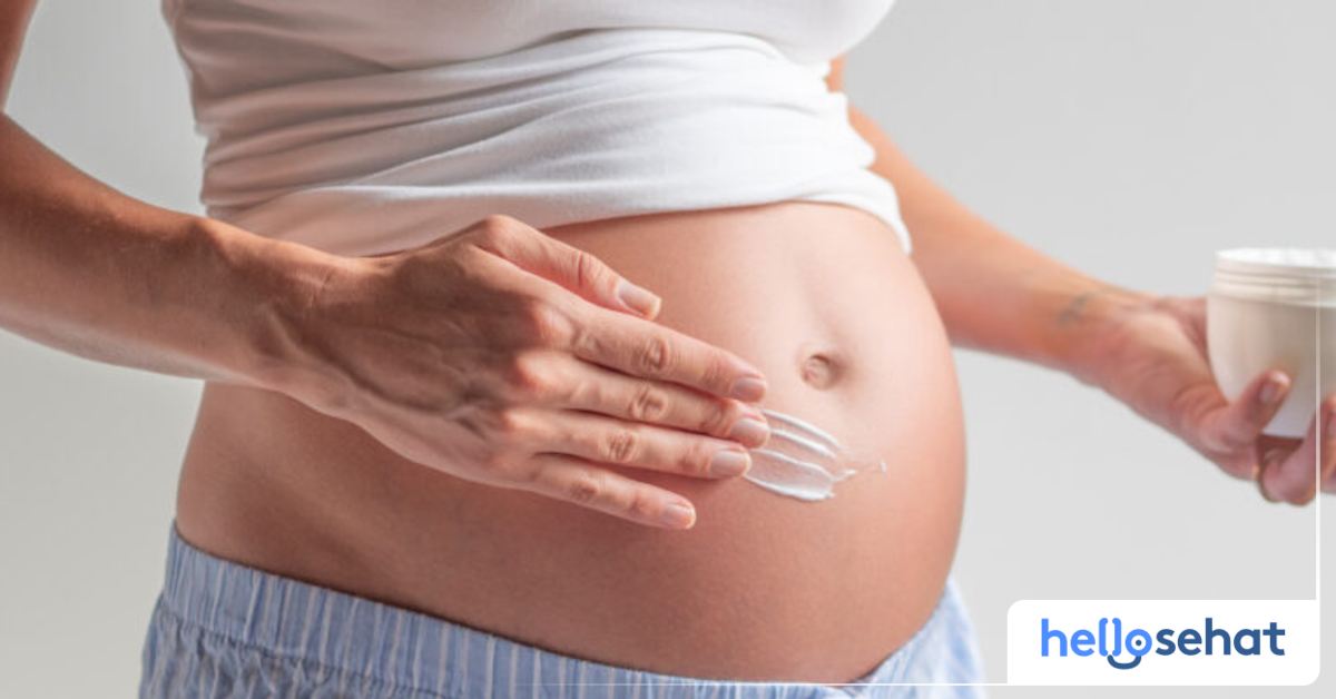 10 Rekomendasi Cream Penghilang Stretch Mark Terbaik - Hello Sehat