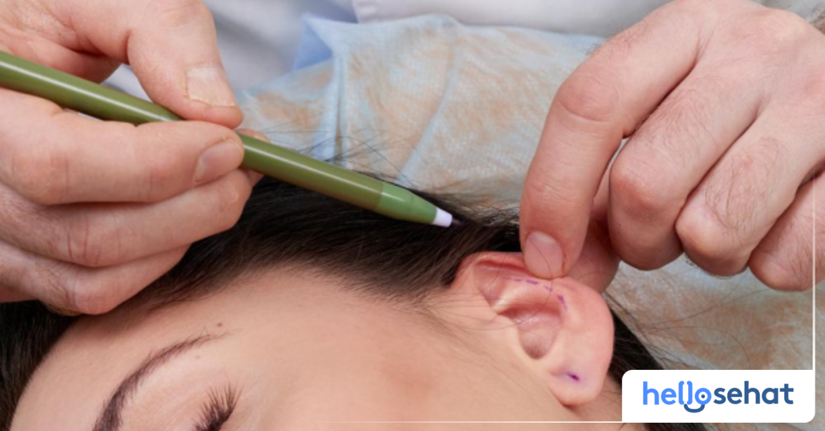 Otoplasty, Operasi untuk Memperbaiki Kondisi Daun Telinga | Hello Sehat