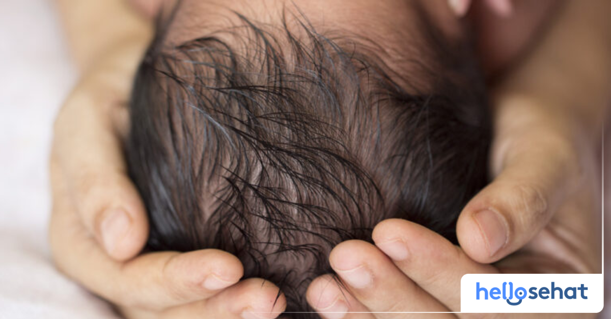10 Rekomendasi Minyak untuk Melebatkan Rambut Bayi - Hello Sehat