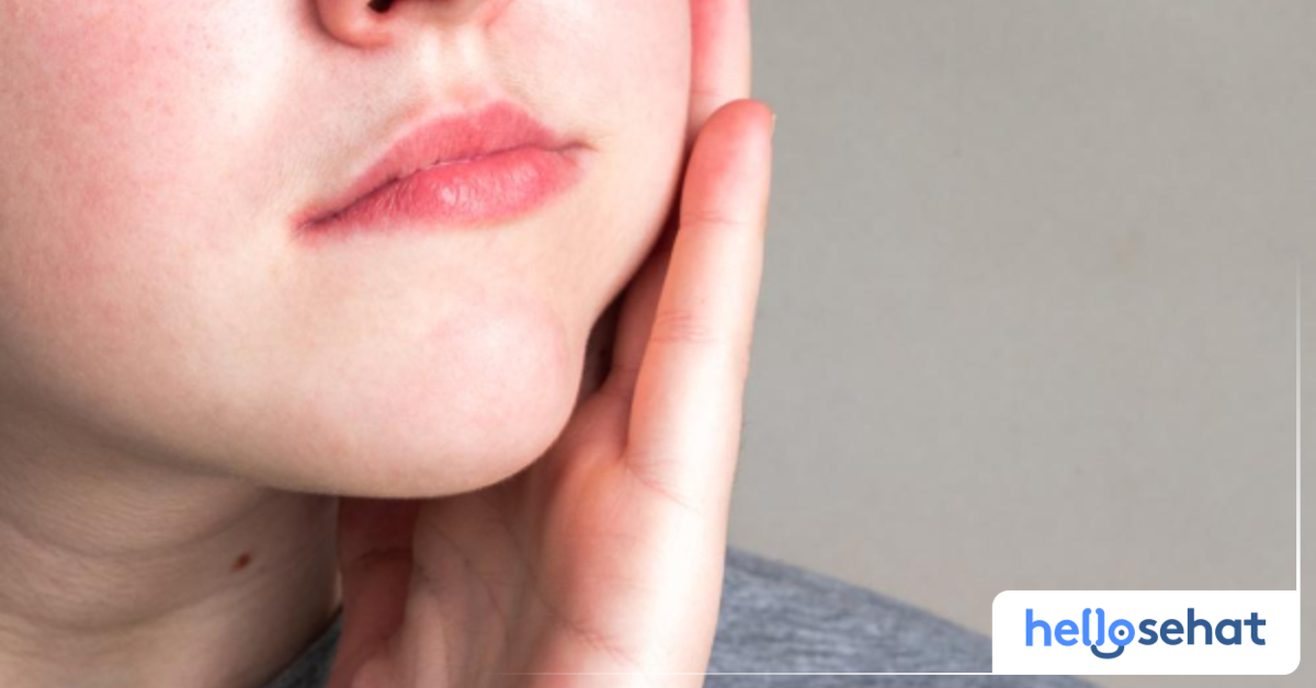 10 Macam Kondisi yang Menjadi Penyebab Pipi Bengkak - Hello Sehat