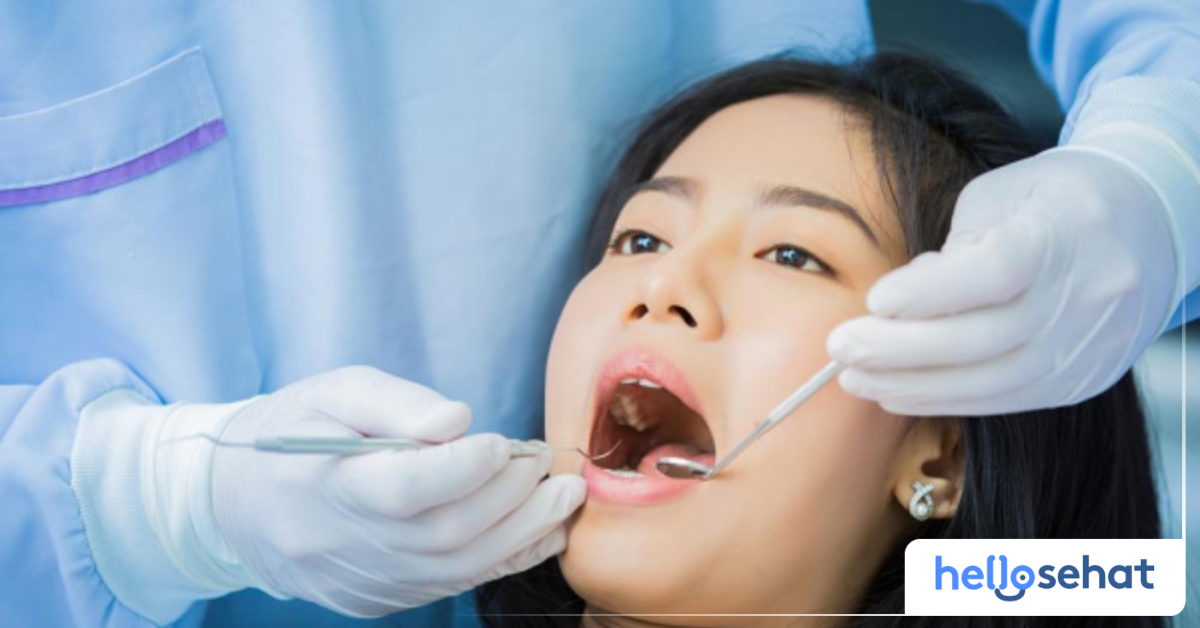 Penyebab Lapisan Putih di Gusi setelah Cabut Gigi - Hello Sehat