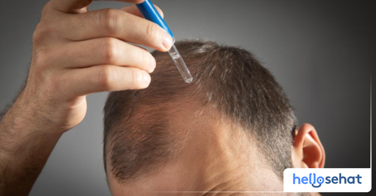 10 Rekomendasi Minyak Rambut Pria Terbaik dan Bagus - Hello Sehat